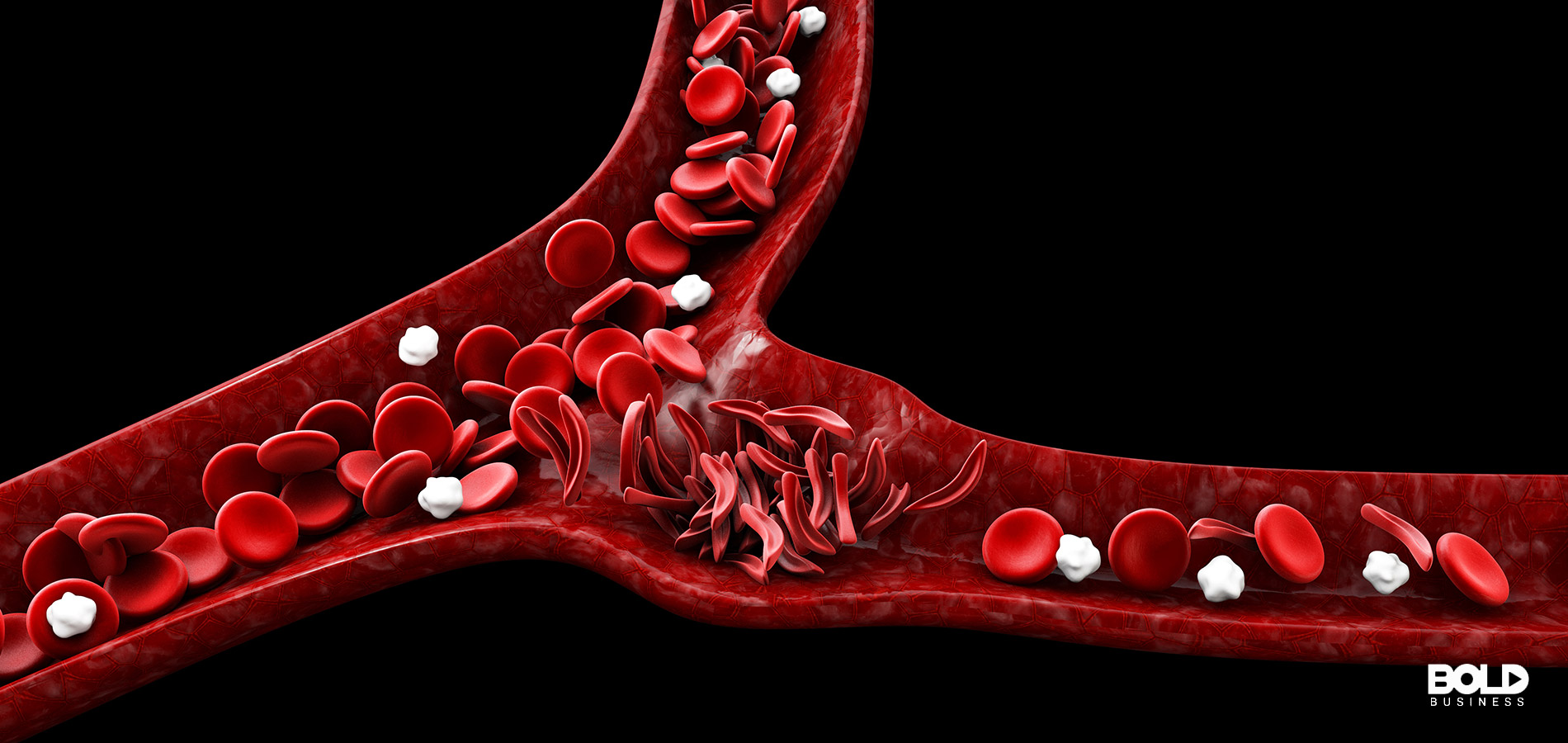 Defeating Sickle Cell Once and for All